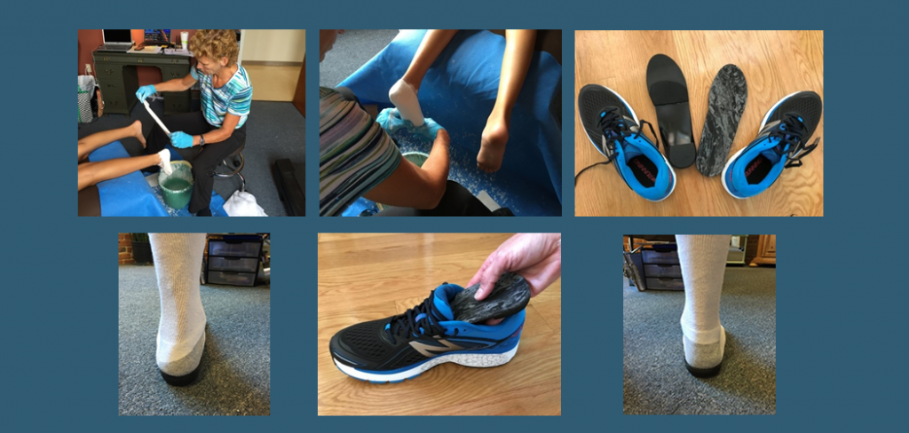 Custom Foot Orthotics | Sole Remedy Foot Care