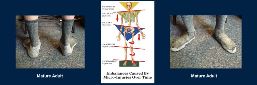 Gait Pattern Feet2 | Sole Remedy Foot Care