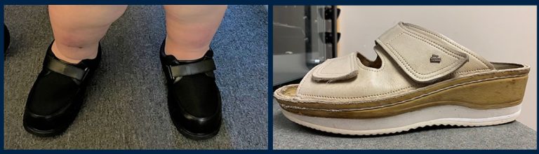 Spinal Stenosis | Sole Remedy Foot Care